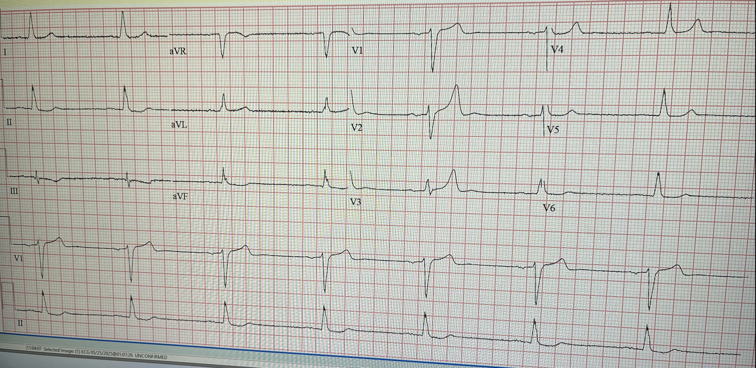 Bradycardia — When the Beat Drops: A Resident's Guide to the CCU