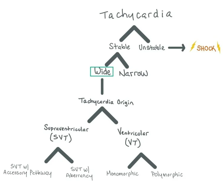 Wide Complex Tachycardia — When the Beat Drops: A Resident's Guide to ...