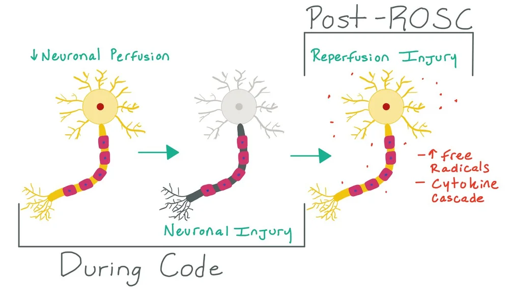 Targeted Temperature Management (TTM) — When the Beat Drops: A Resident ...
