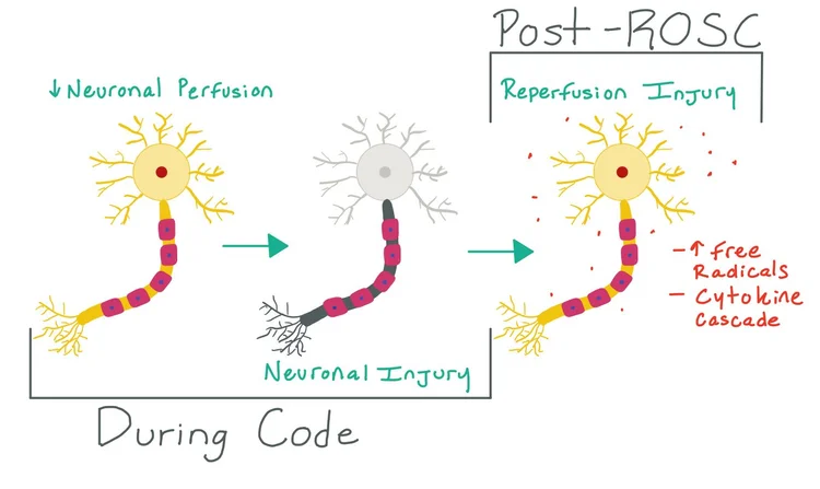 Targeted Temperature Management (TTM) — When the Beat Drops: A Resident ...