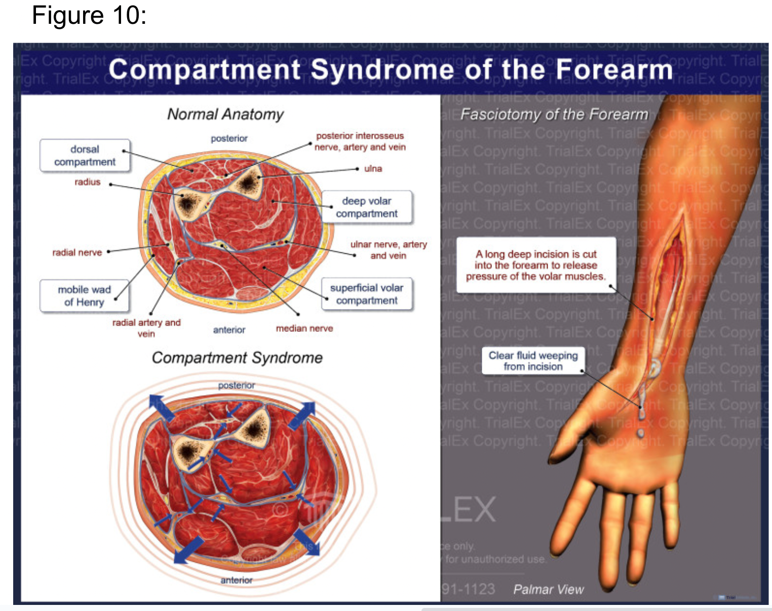 Right Heart Catheterization vs. Left Heart Catheterization vs. Coronary ...