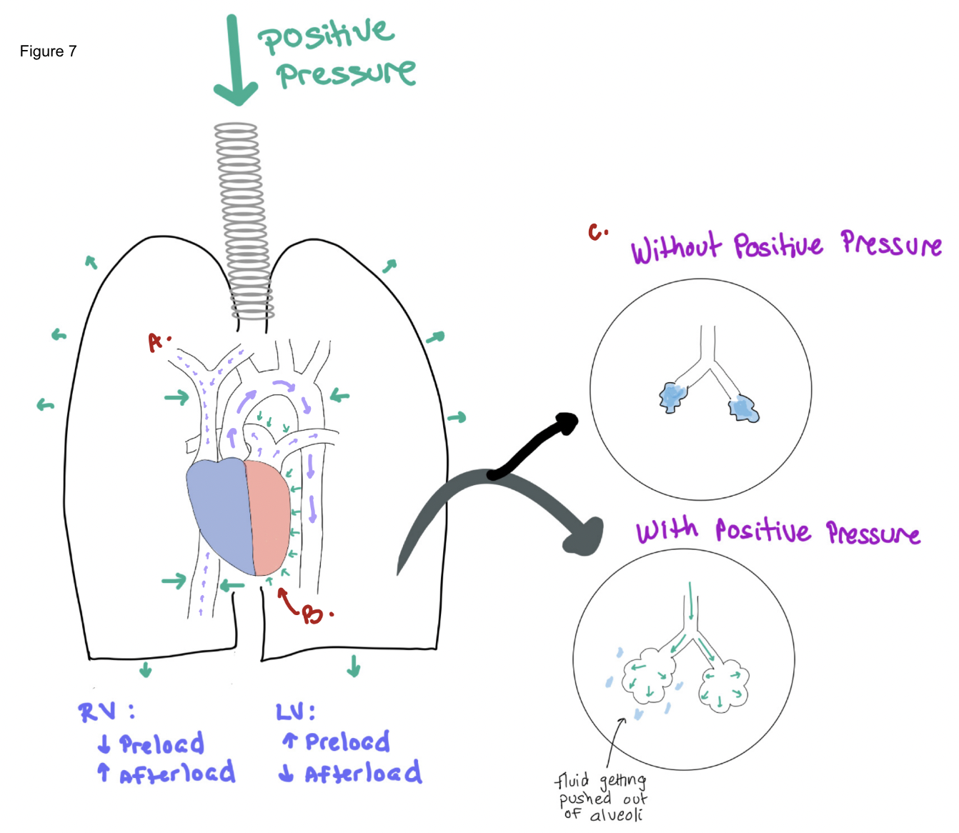 Non-Invasive Positive Pressure Ventilation — When the Beat Drops: A ...