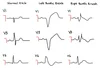 Bradycardia — When the Beat Drops: A Resident's Guide to the CCU
