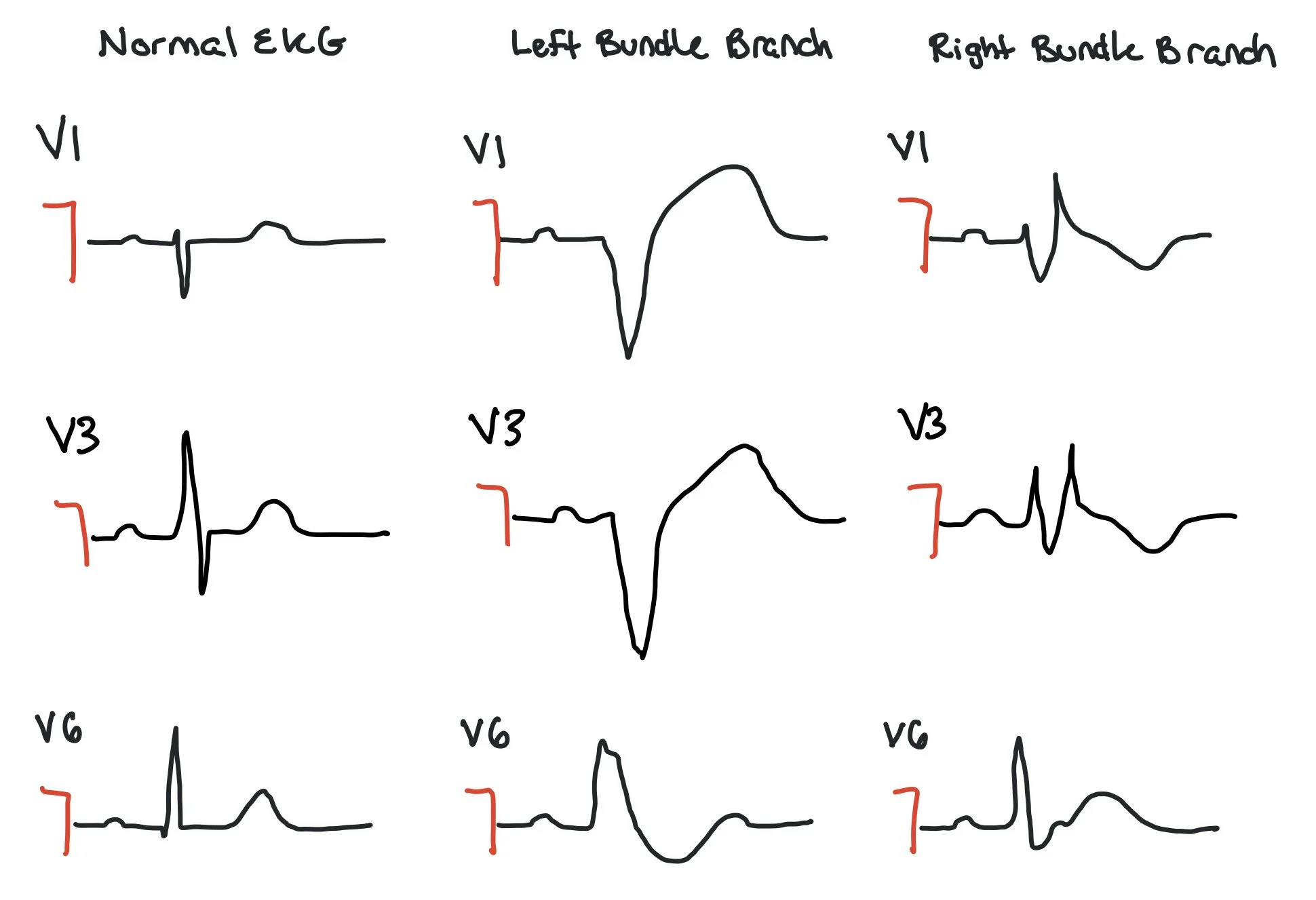 Bradycardia — When the Beat Drops: A Resident's Guide to the CCU