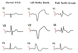 Bradycardia — When the Beat Drops: A Resident's Guide to the CCU