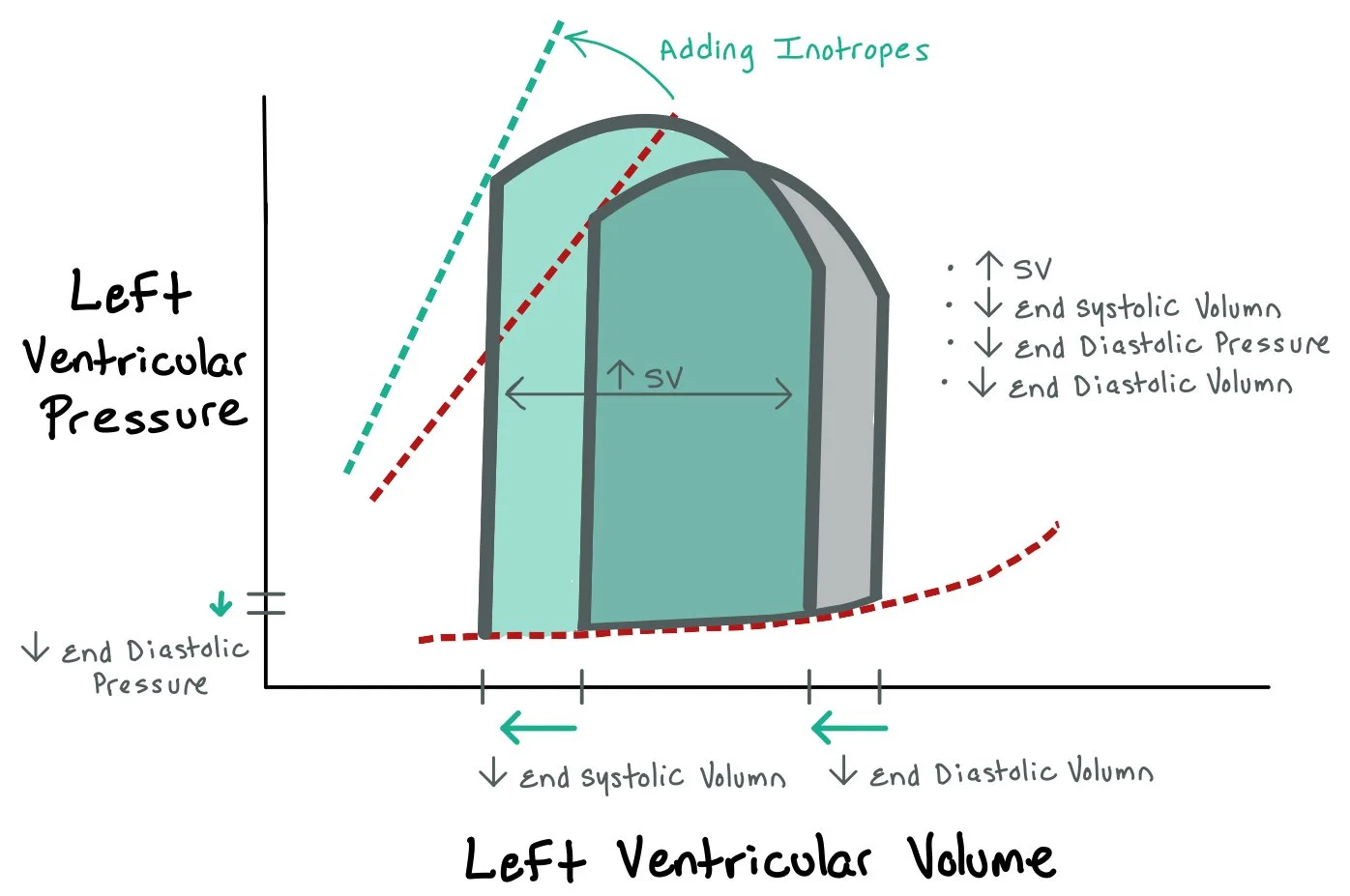 Cardiogenic Shock — When the Beat Drops: A Resident's Guide to the CCU