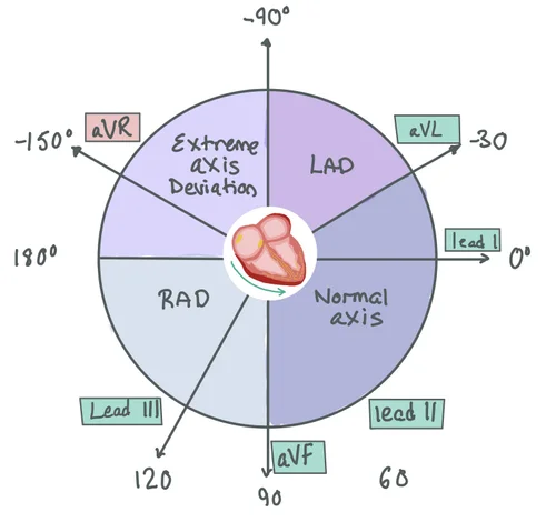 How to Read EKGs — When the Beat Drops: A Resident's Guide to the CCU
