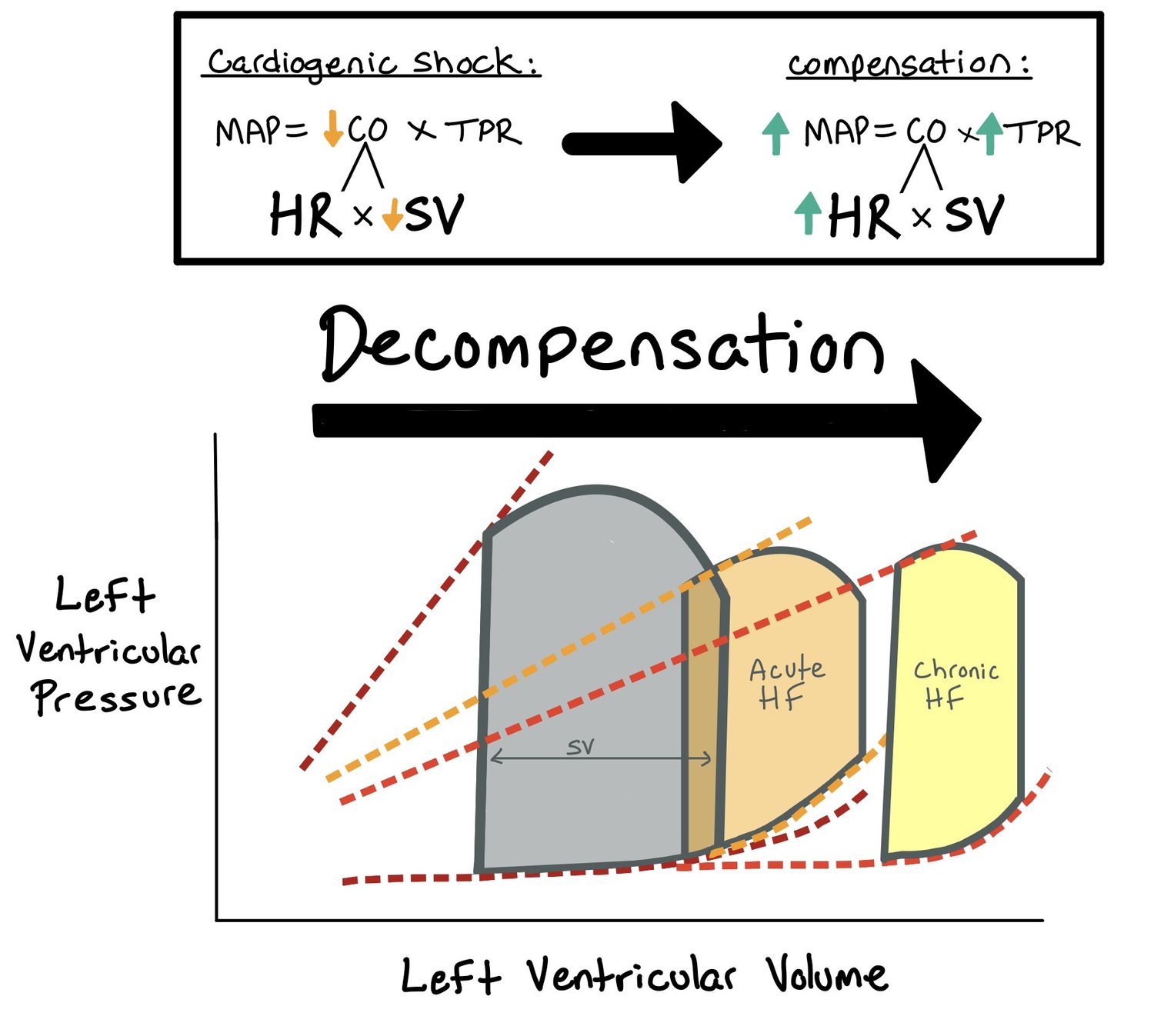 Cardiogenic Shock — When the Beat Drops: A Resident's Guide to the CCU
