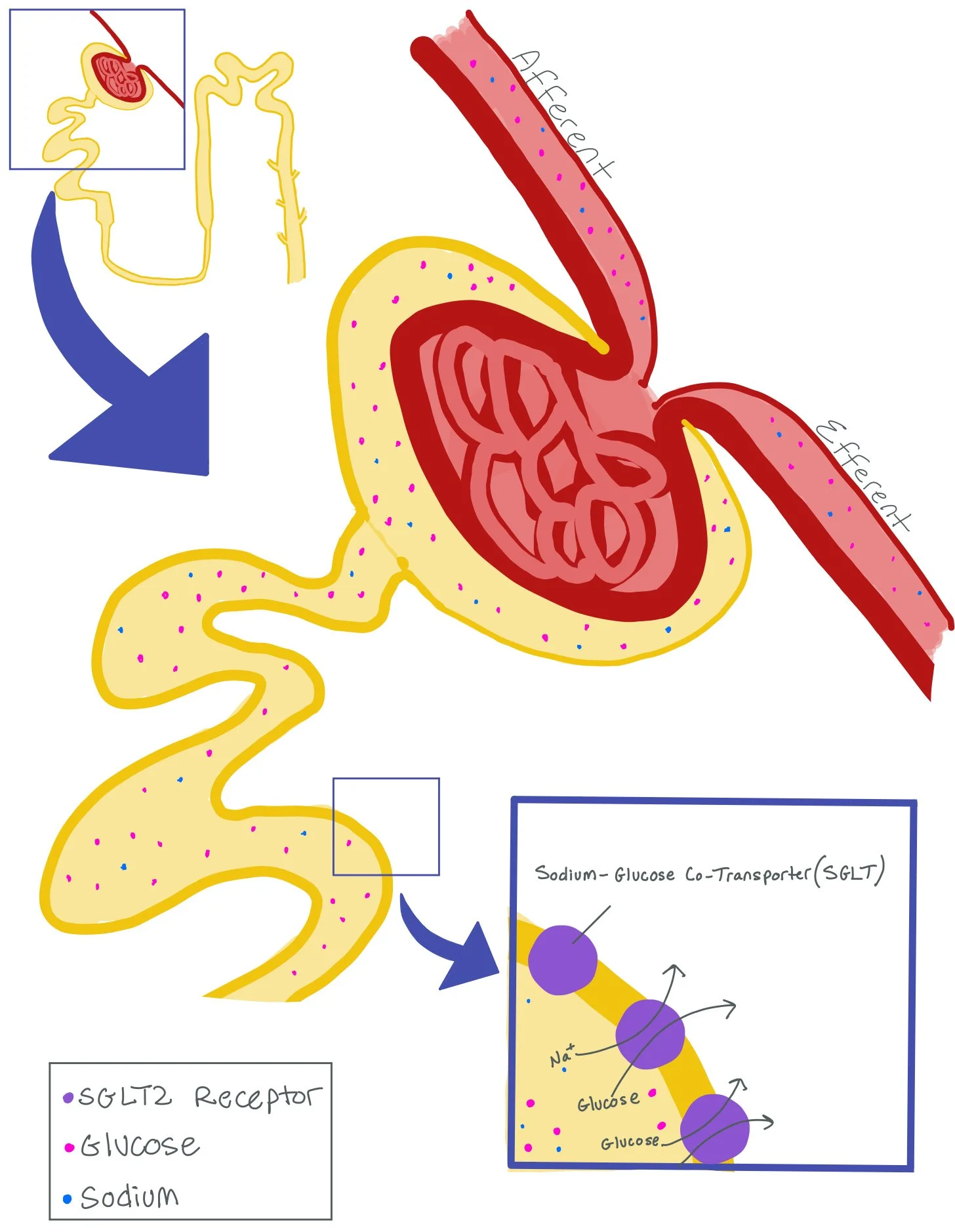 Navigating Indications and Contraindications of SGLT2 Inhibitors — When ...