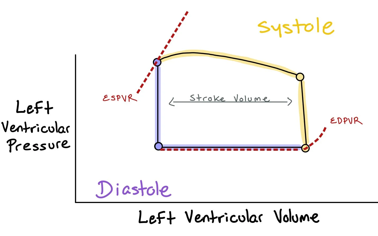 Cardiogenic Shock — When the Beat Drops: A Resident's Guide to the CCU