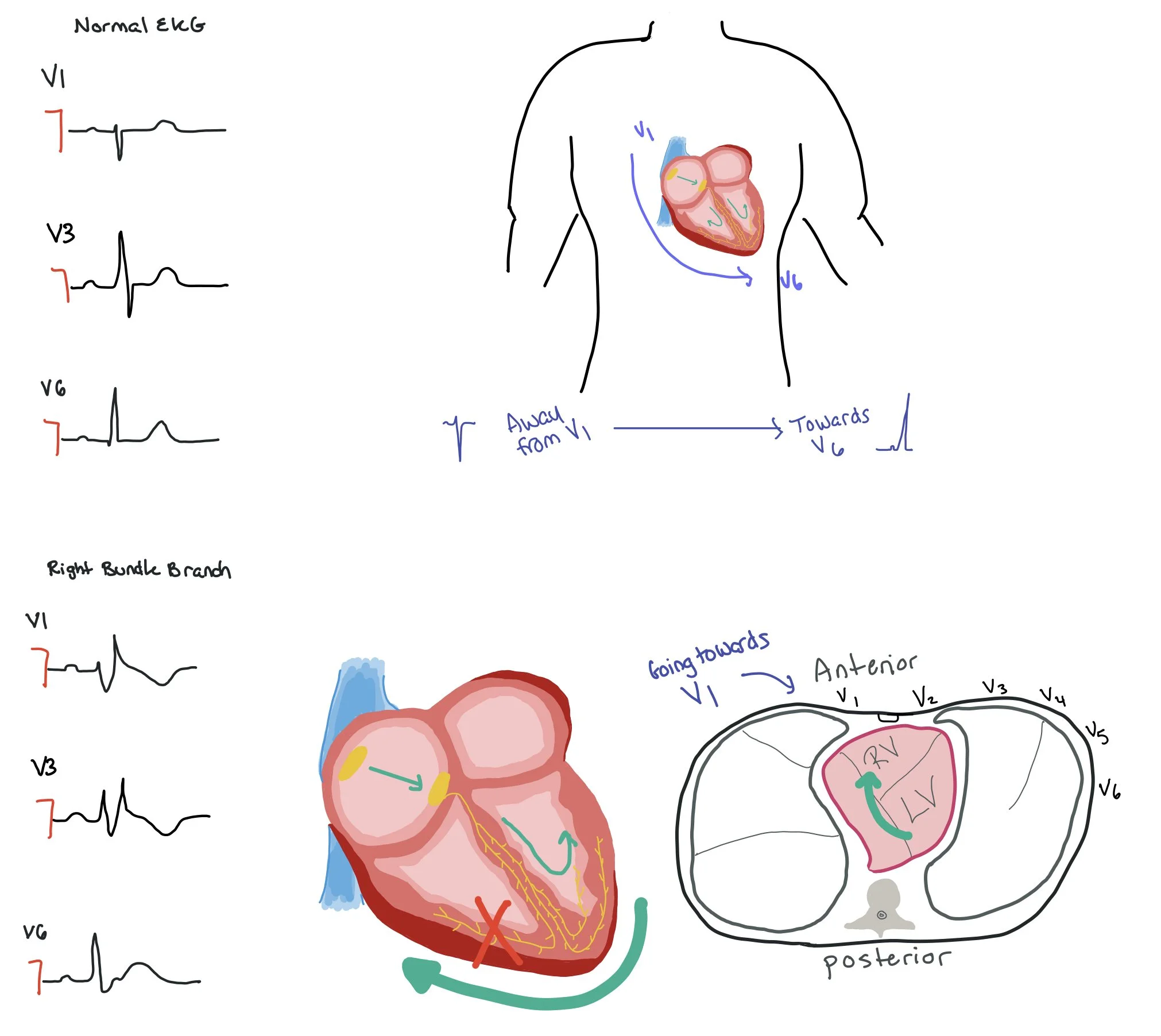 Bradycardia — When the Beat Drops: A Resident's Guide to the CCU