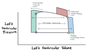 Cardiogenic Shock — When the Beat Drops: A Resident's Guide to the CCU