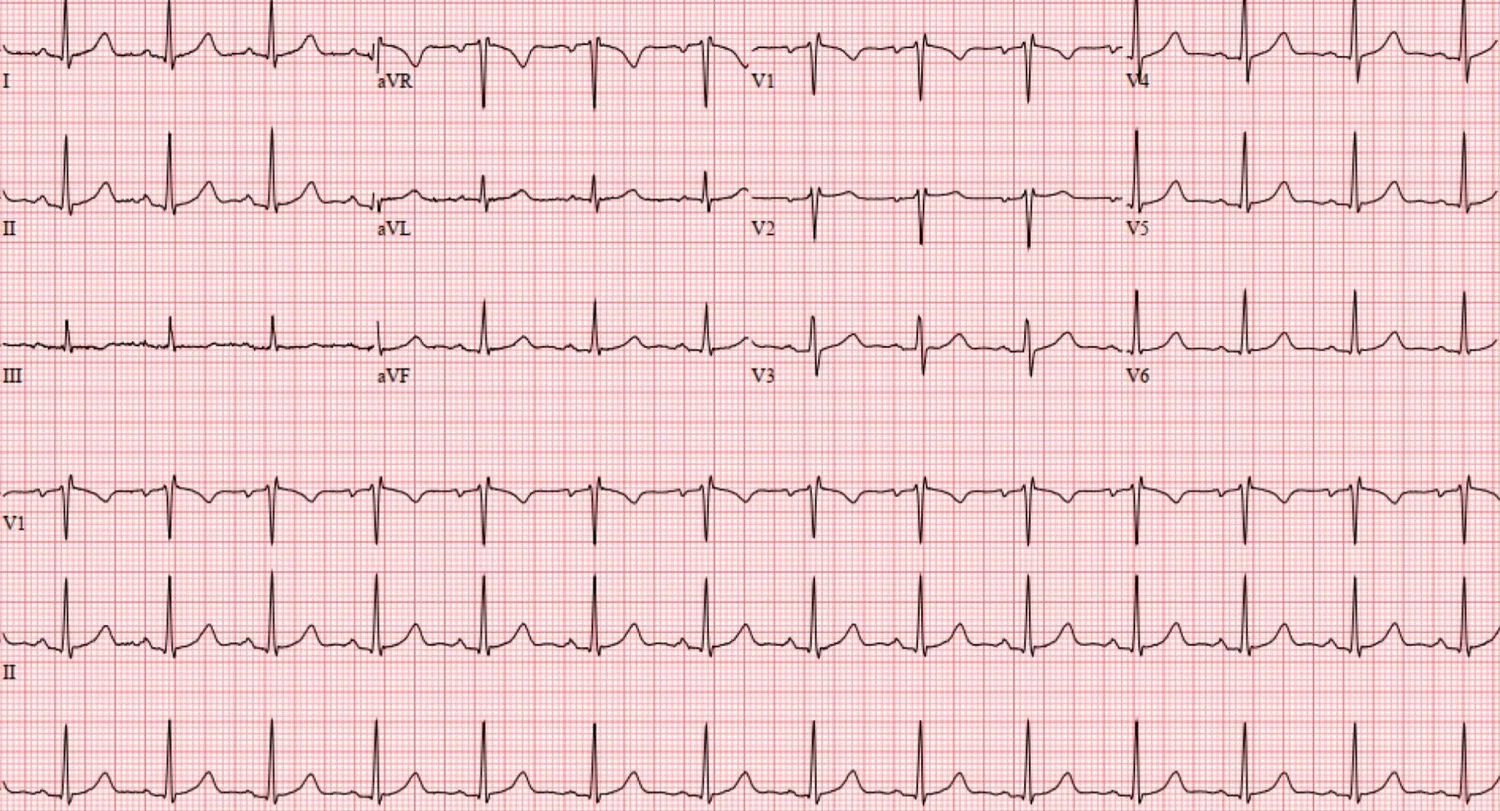 When the Beat Drops: A Resident's Guide to the CCU