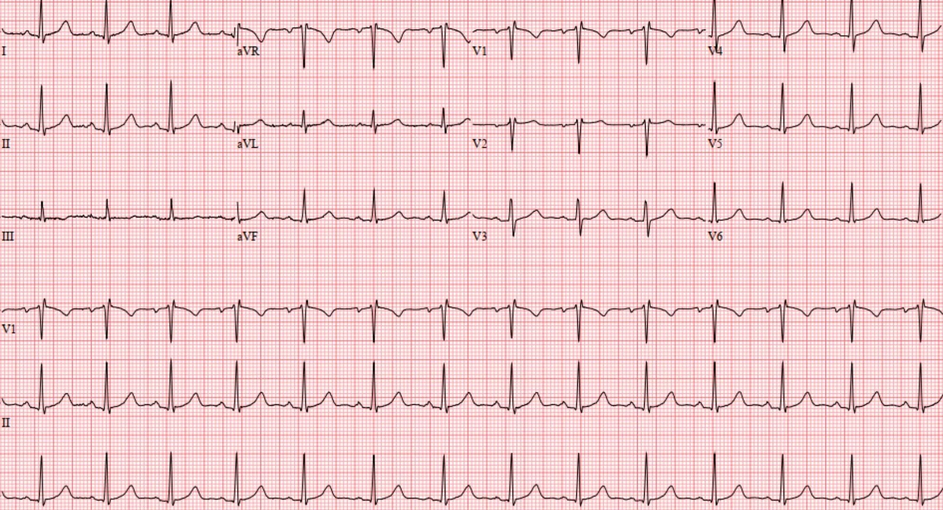When the Beat Drops: A Resident's Guide to the CCU
