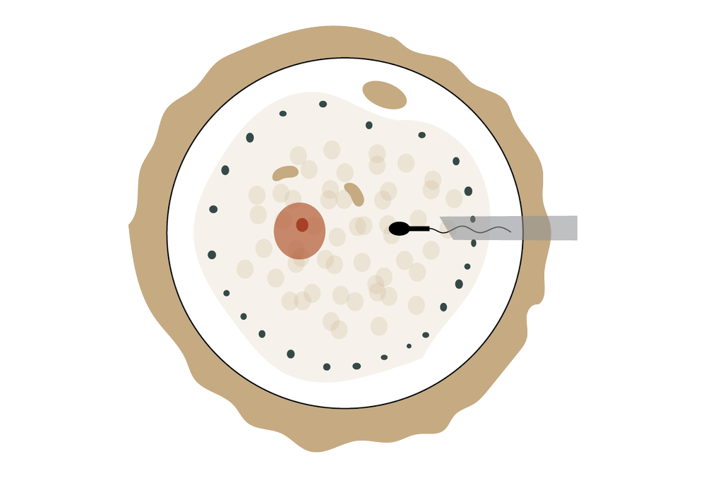 Treatment Costs & Pricing | Accessible Fertility Care in St. Louis ...