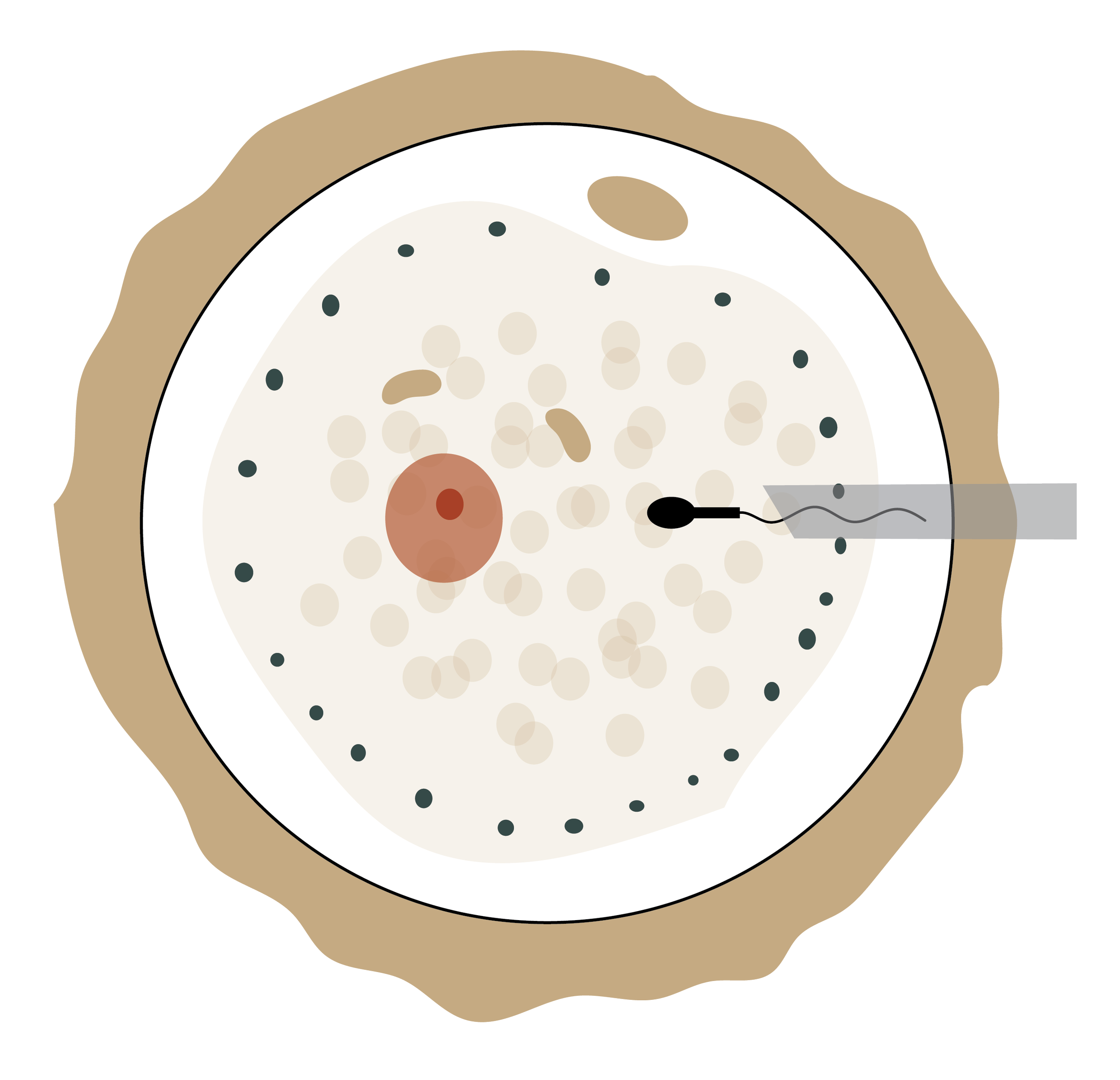 Treatment Option: In Vitro Fertilization (IVF) with Donor Sperm — Arbor ...