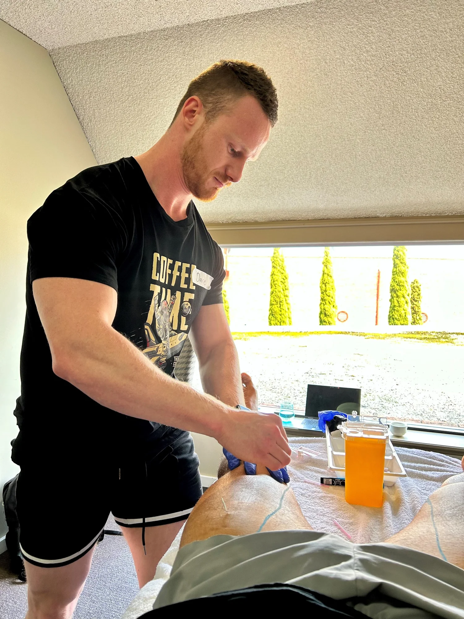 Dry Needling | Explore Pain Relief - Book Your Dry Needling Session ...