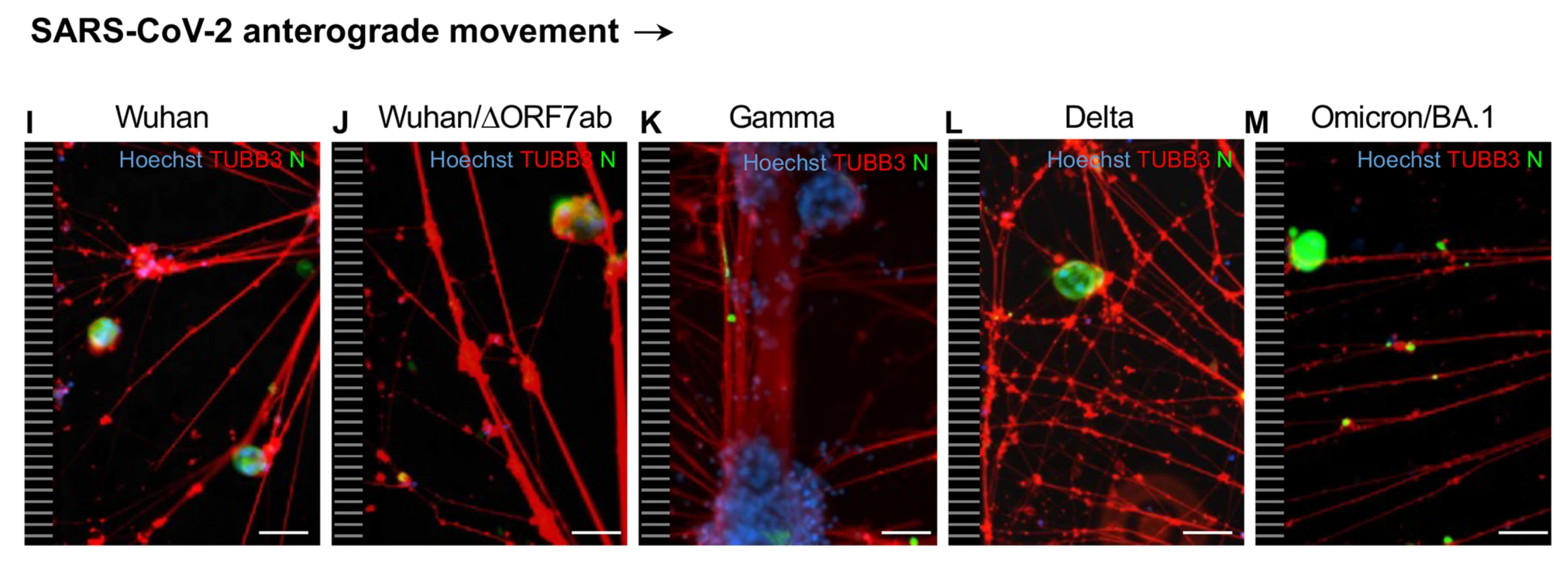 Reviews — MICROBRAIN BIOTECH