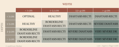 Diagnosis — Diastasis Recti UK CIC