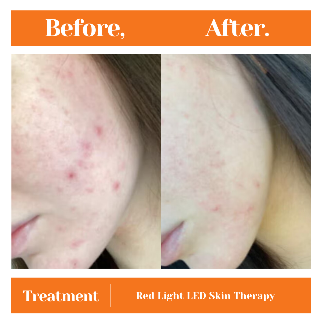 Before & After Results | Alive Co Brisbane Treatments — Alive Co Brisbane