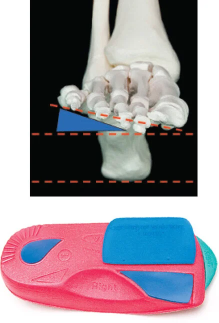 Orthotic Additions — Vasyli Medical