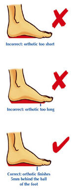 How to Dispense Orthotics — Vasyli Medical