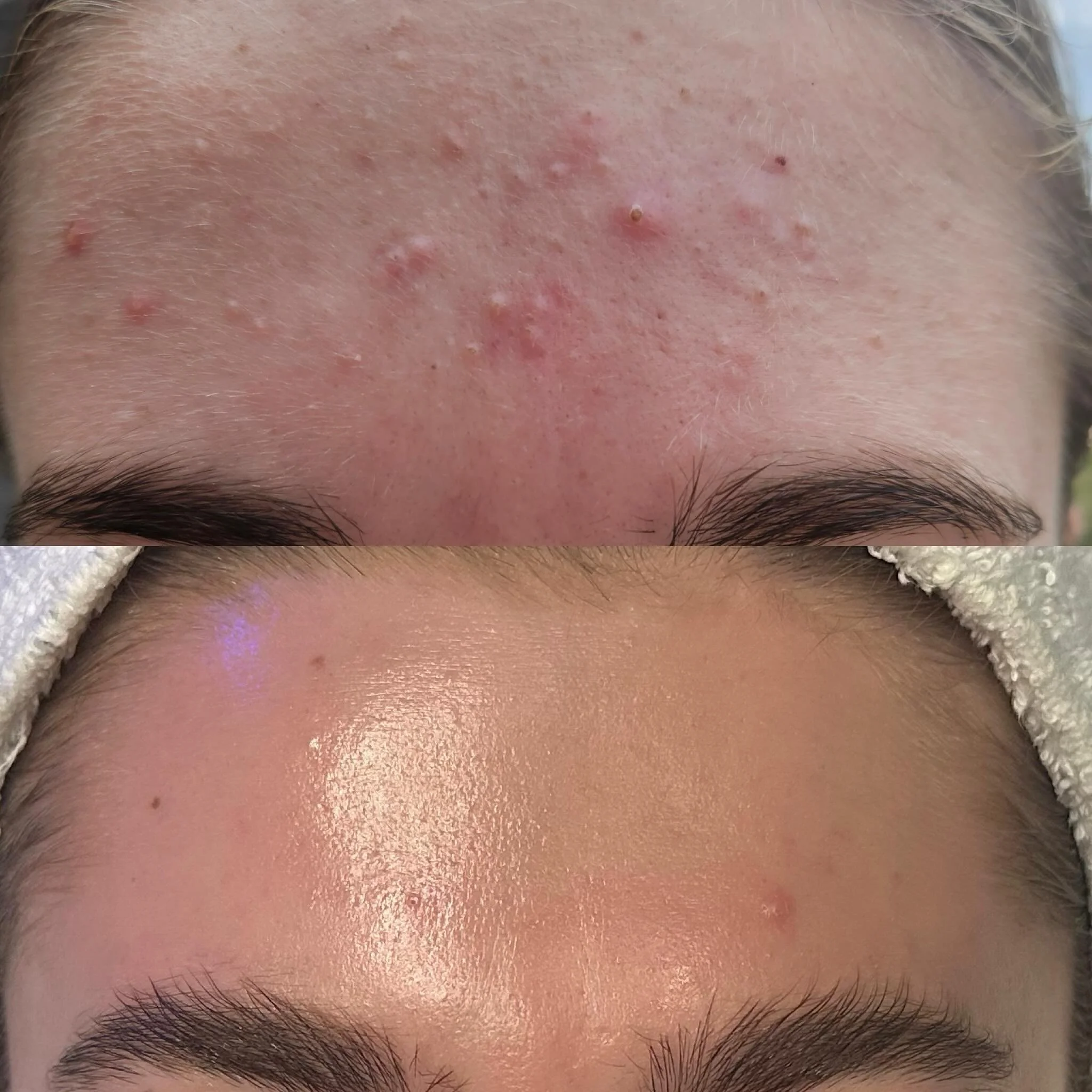 Skin Services Enhanced Esthetics Co Skin Services Enhanced Esthetics Co
