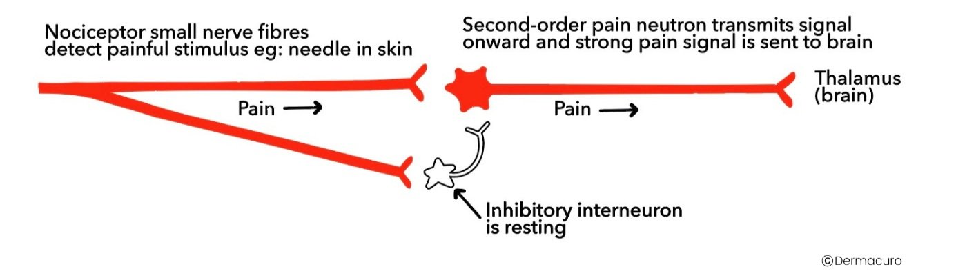 Dermacuro Pain Blocker | Reduce Patient Discomfort During Procedures ...