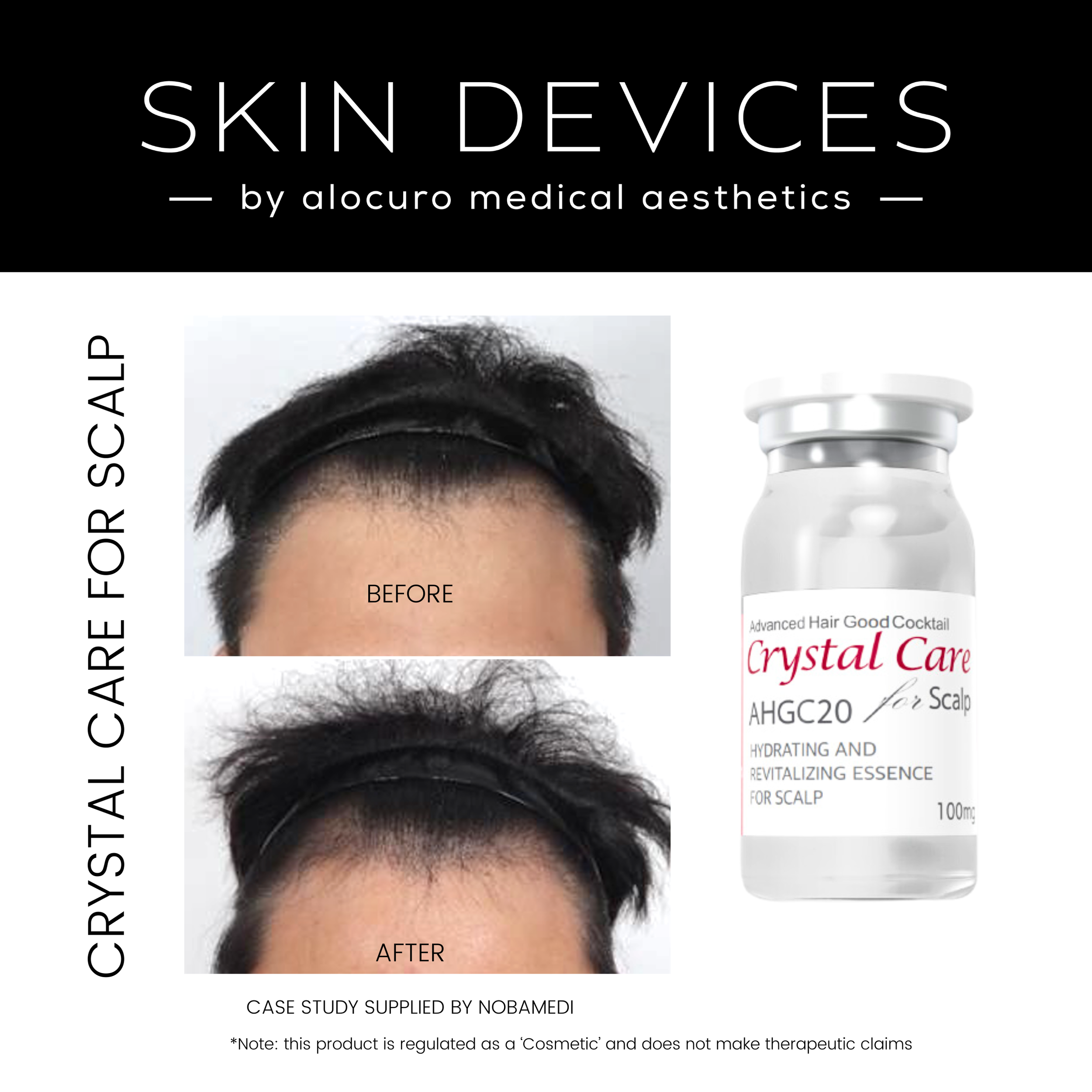 Nobamedi Crystal Care Serum for Scalp — Skin Devices