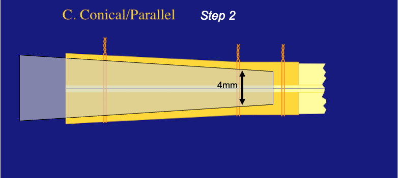 Conical/Parallel Fulcrum Procedure — London Fields Reed Shack