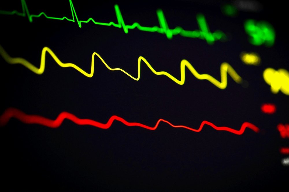 Sleep Apnea Study Scoring Services| Remote Scoring Help| Sleep Expert ...