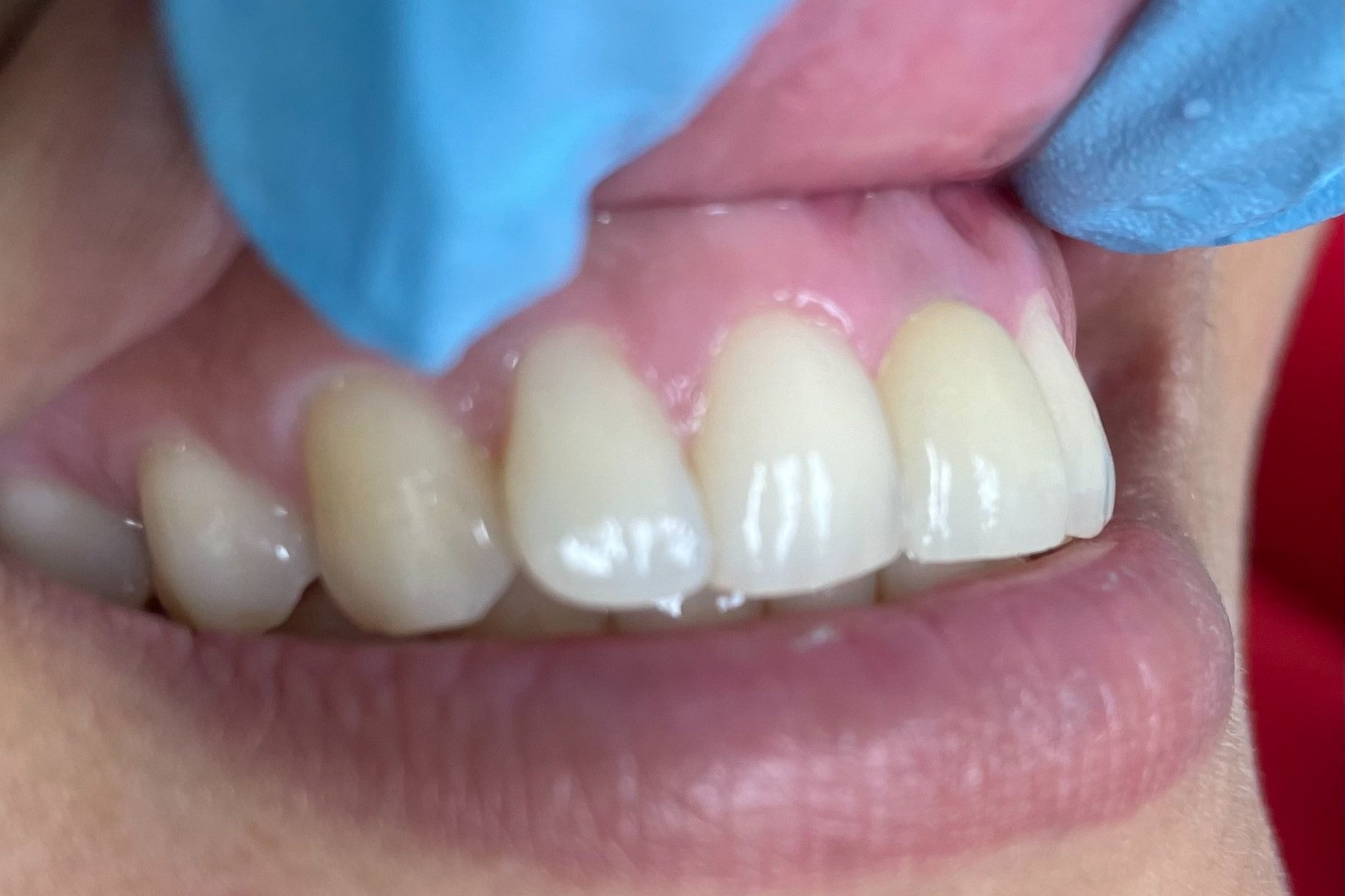Smilodon Dental - Locally Owned Nashville, TN Dentist & Implants