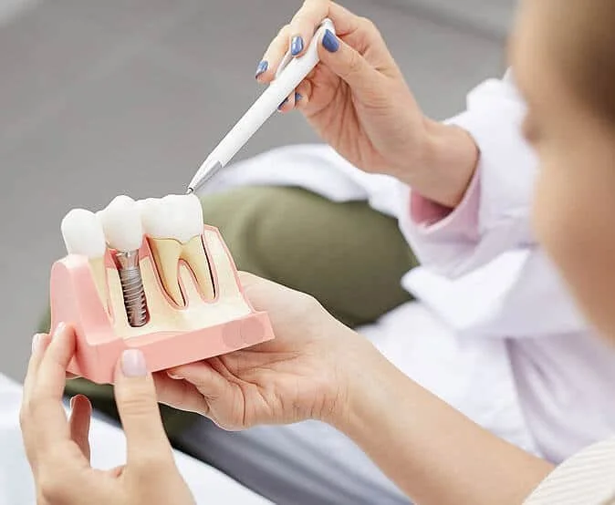 Dental Implant Restorations — Dr. Cait Smiles