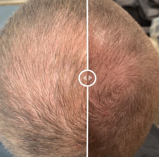 BODY PRESERVE | Scottsdale's #1 Aesthetic Clinic