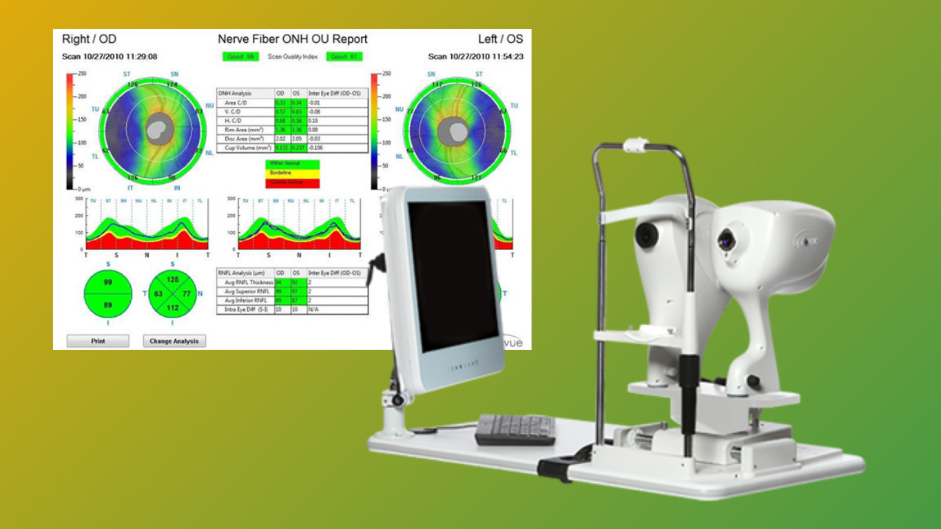Technology & Equipments — The Eye Works Optometry