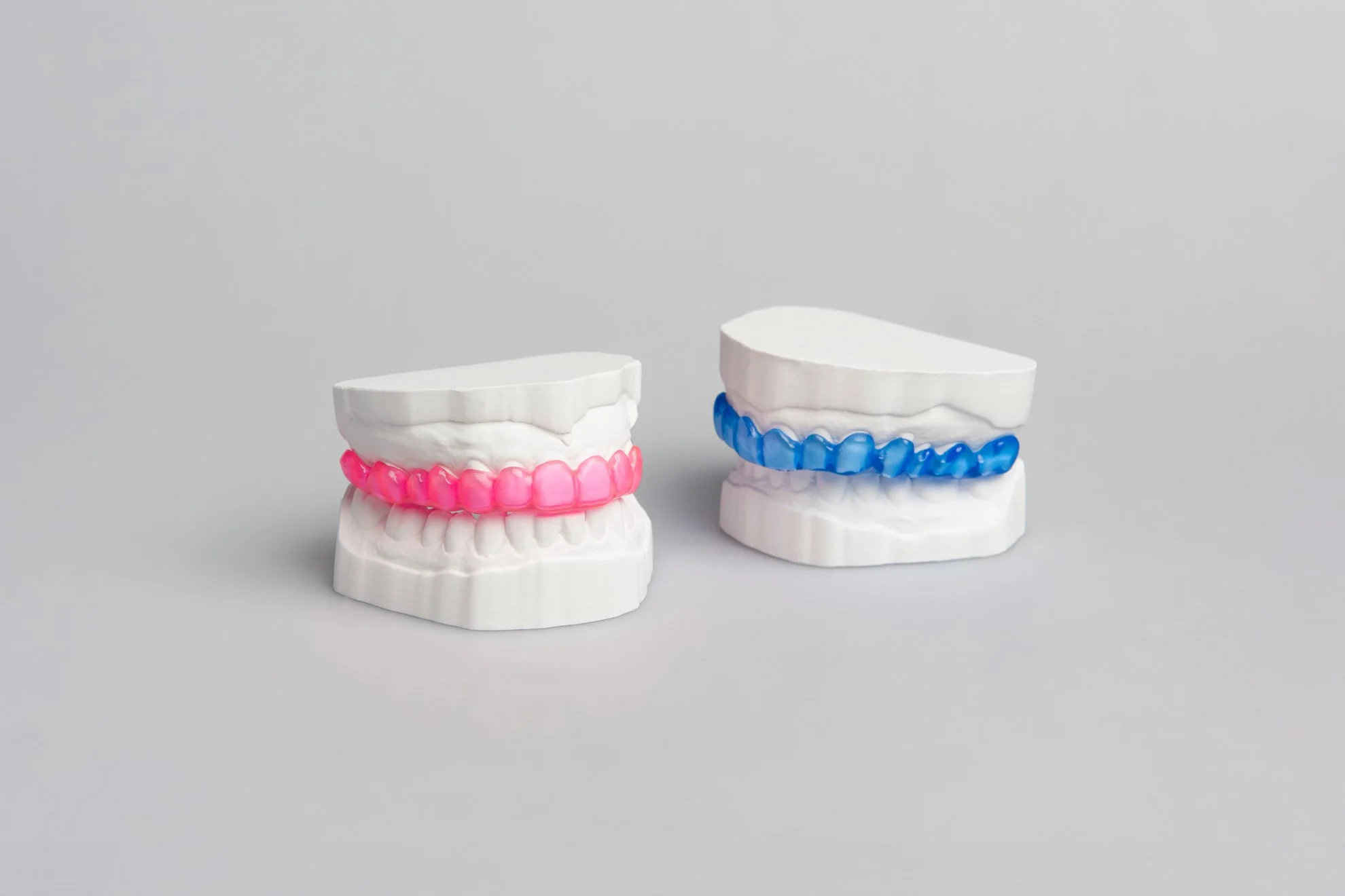 Protect Teeth with Dental Splints for TMJ — Dentax Dental Laboratory