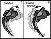 Infrasternal Angle: What it is and Why its Important — ROSA PERFORMANCE ...