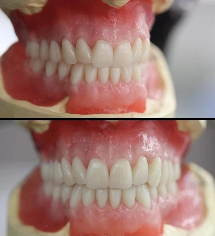 Our Dental Prosthetic Services - Spartan Dental Laboratory Offering ...