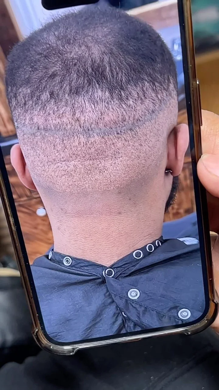 Gerow Hair Ink The #1 Scalp Micropigmentation Clinic