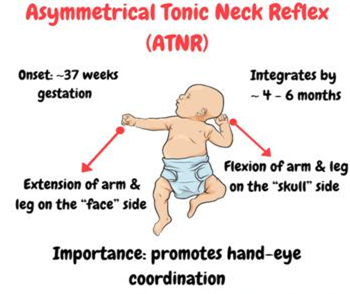 Spotlight on the ATNR: Asymmetrical Tonic Neck Reflex — Freshwater ...