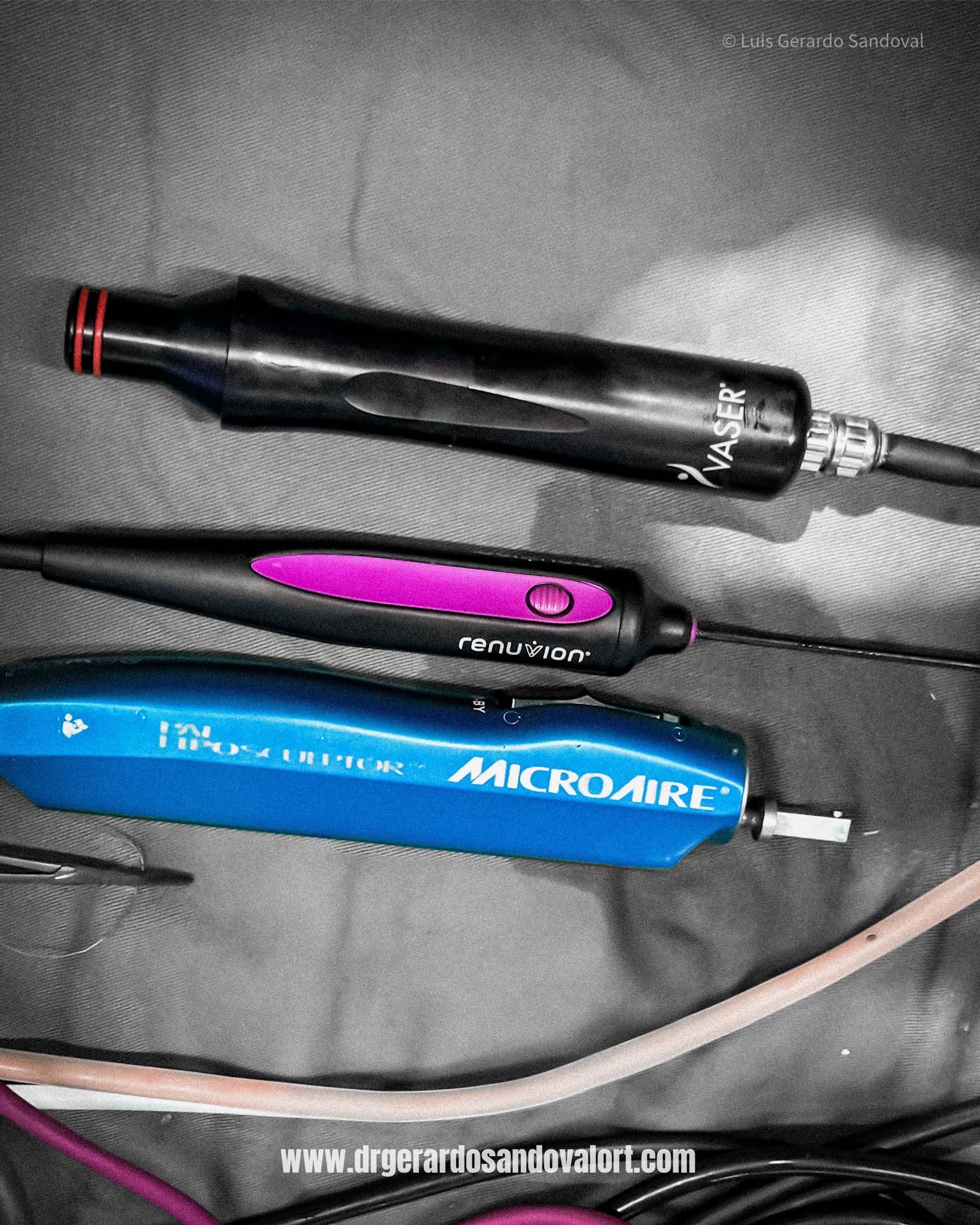 Dr. Luis Gerardo Sandoval: VASER® Lipo y Lipoescultura 360 de Alta ...