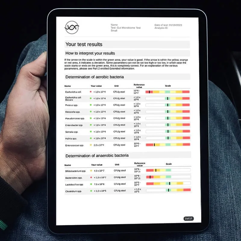 Best gut microbiome tests in the UK — Hello Gut Health