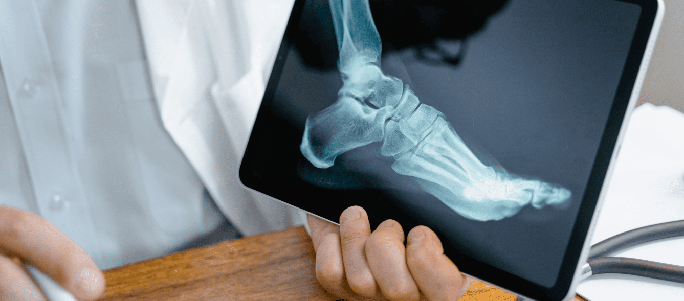 Top 10 Things Auditors Look for in Orthopedic Coding