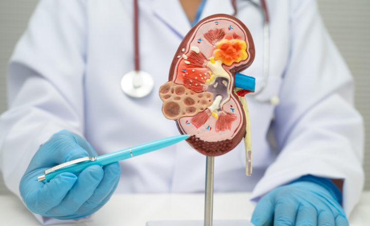 Nephrology & Dialysis Billing Cheat Sheet: CPT Codes & Tips