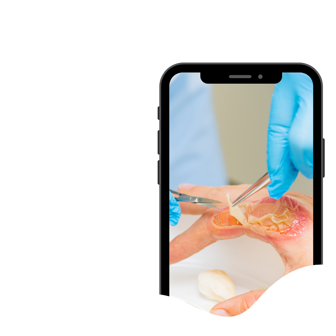 StemSys — Products | Innovative Wound Healing Solutions