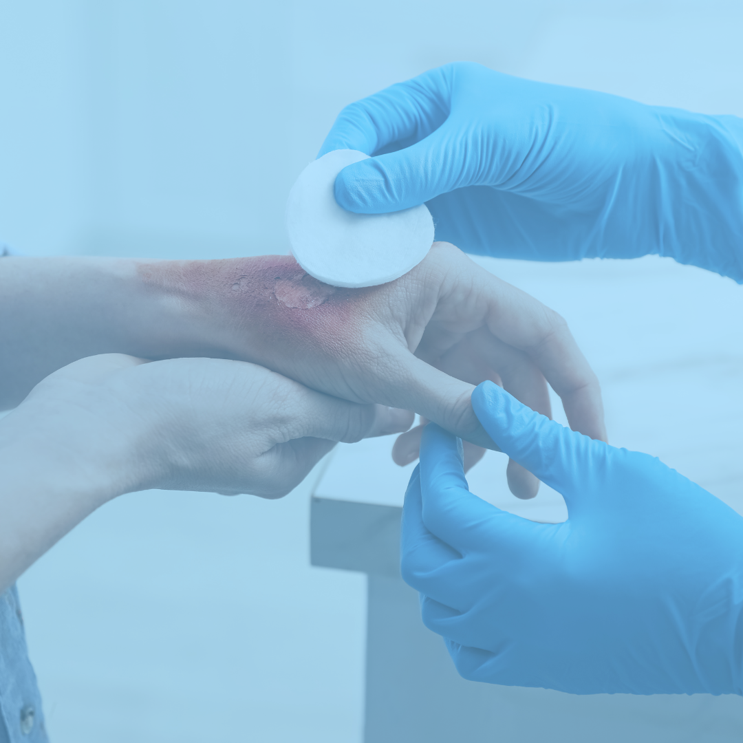 StemSys | Helping Even the Most Severely Injured Heal