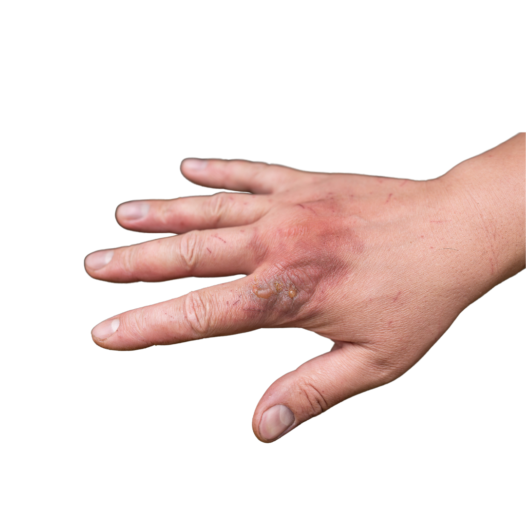 MTP Technology — StemSys