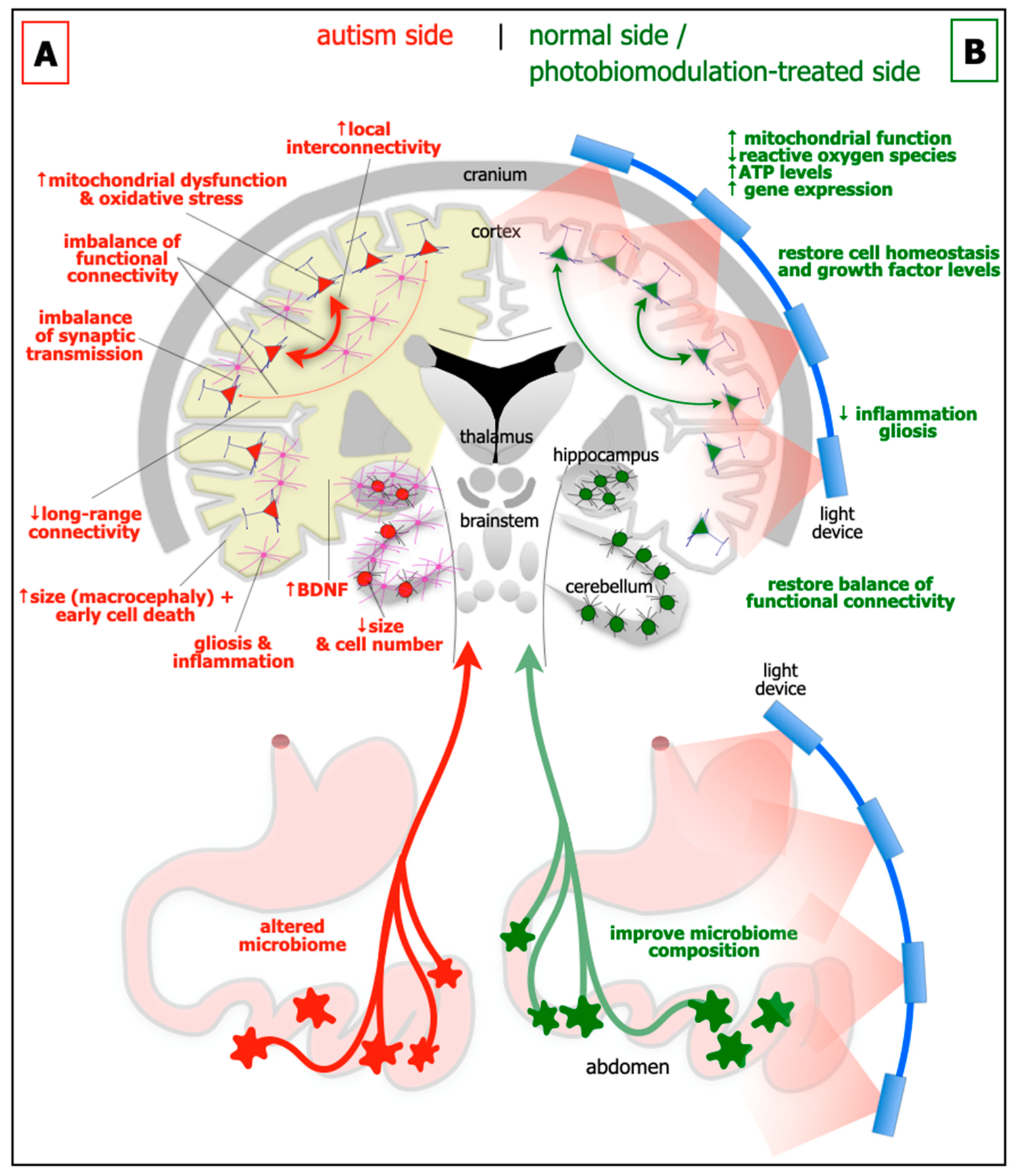 Can Light Ease Autism Traits? | Bradley Engwall, MD, FAPA