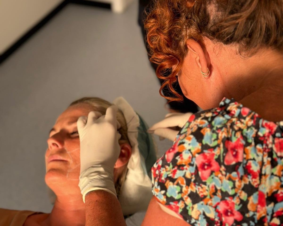 PDO Draadlift — Smooth operator | Botox | Haarlem