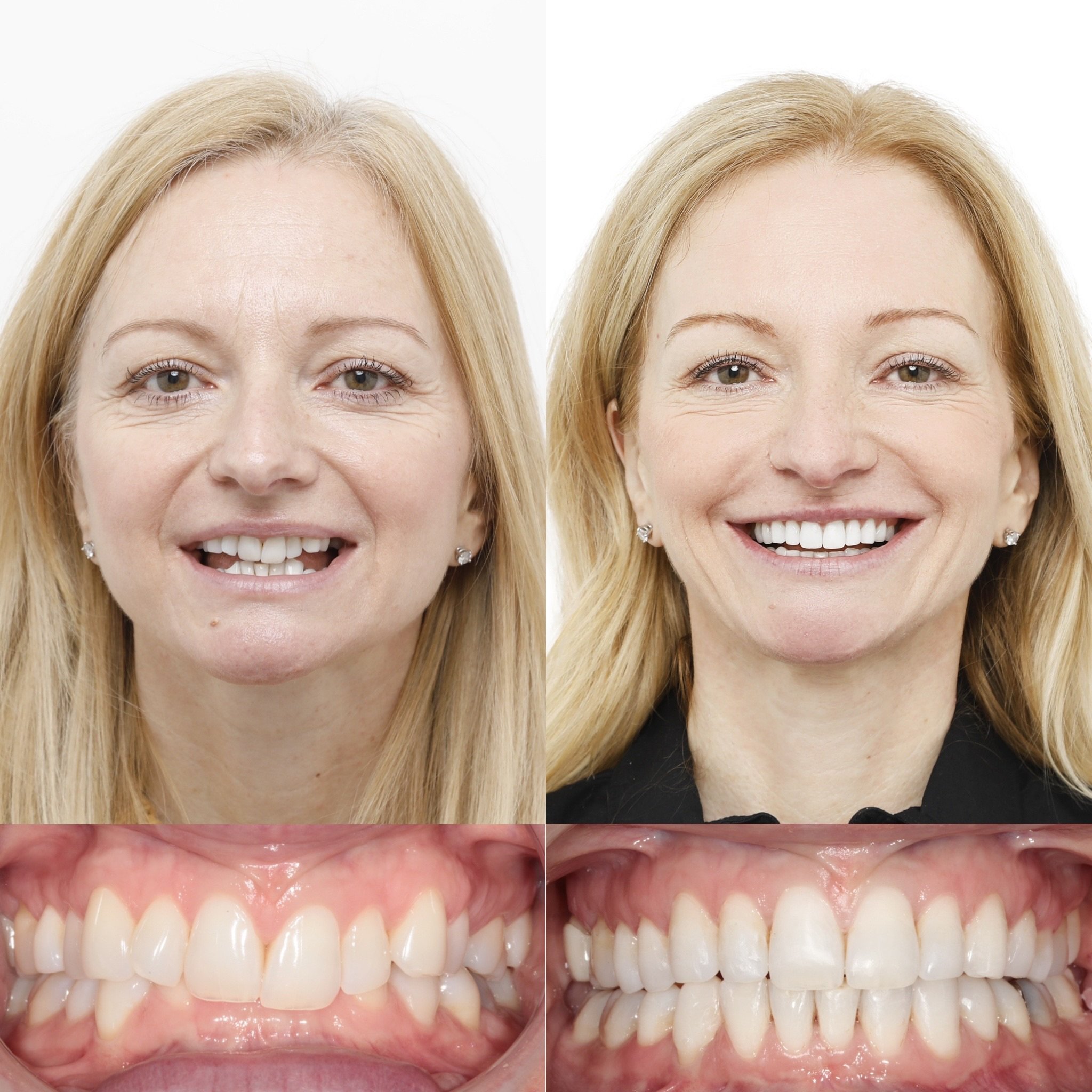 Maccaro Orthodontics in Garden City | Maccaro Smiles